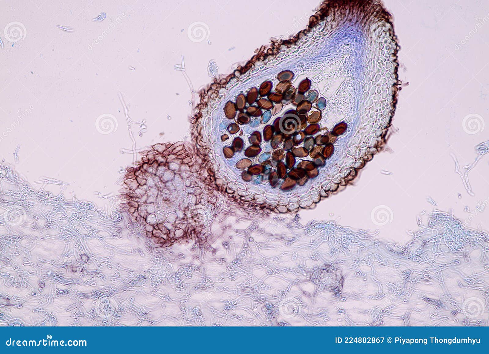 Inside Microscope View At Histology Glass Slide Royalty-Free Stock ...