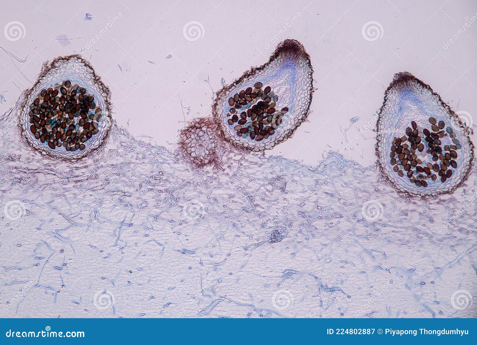 Inside Microscope View At Histology Glass Slide Stock Photo ...