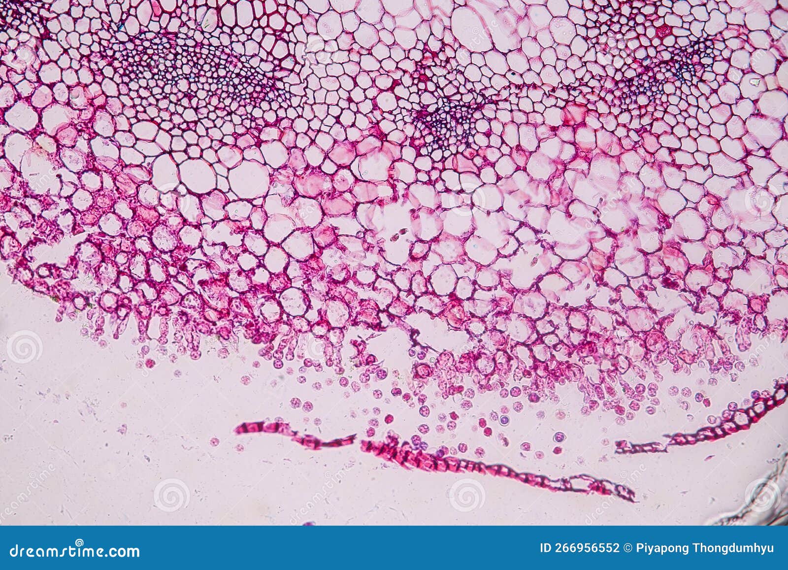 Host Cells with Spores Mold are Inside Wood Under the Microscope. Stock ...