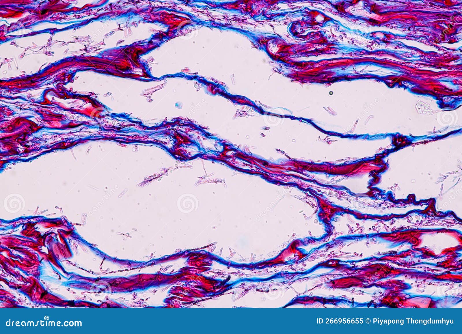 Host Cells with Spores Mold are Inside Wood Under the Microscope. Stock ...