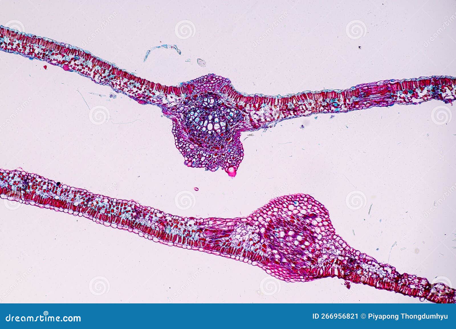 Host Cells with Spores Mold are Inside Wood Under the Microscope. Stock ...