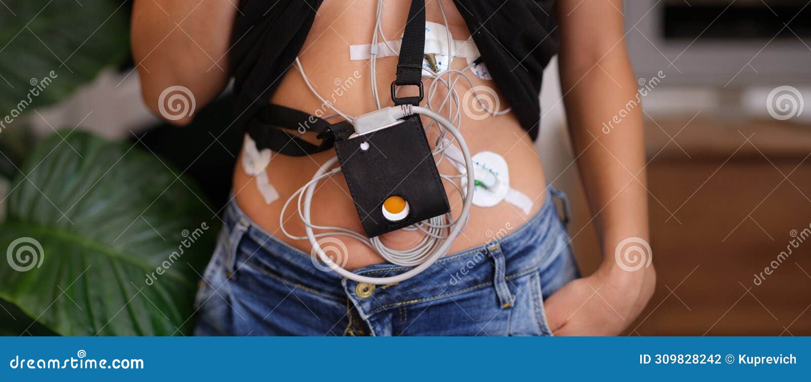 24-hour ECG Monitoring and Holter Monitoring on a Woman Body Stock ... 24-hour ECG Monitoring and Holter Monitoring on a Woman Body Stock ...