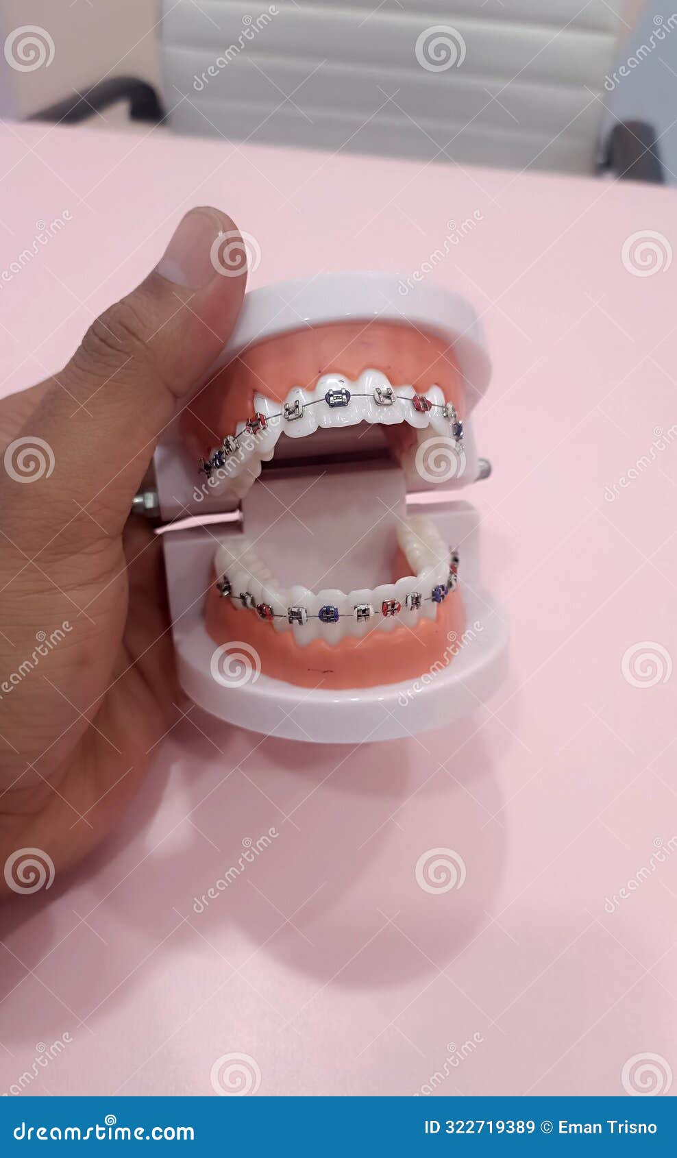 How To Install Brackets on Tooth Models Stock Image - Image of tooth ...