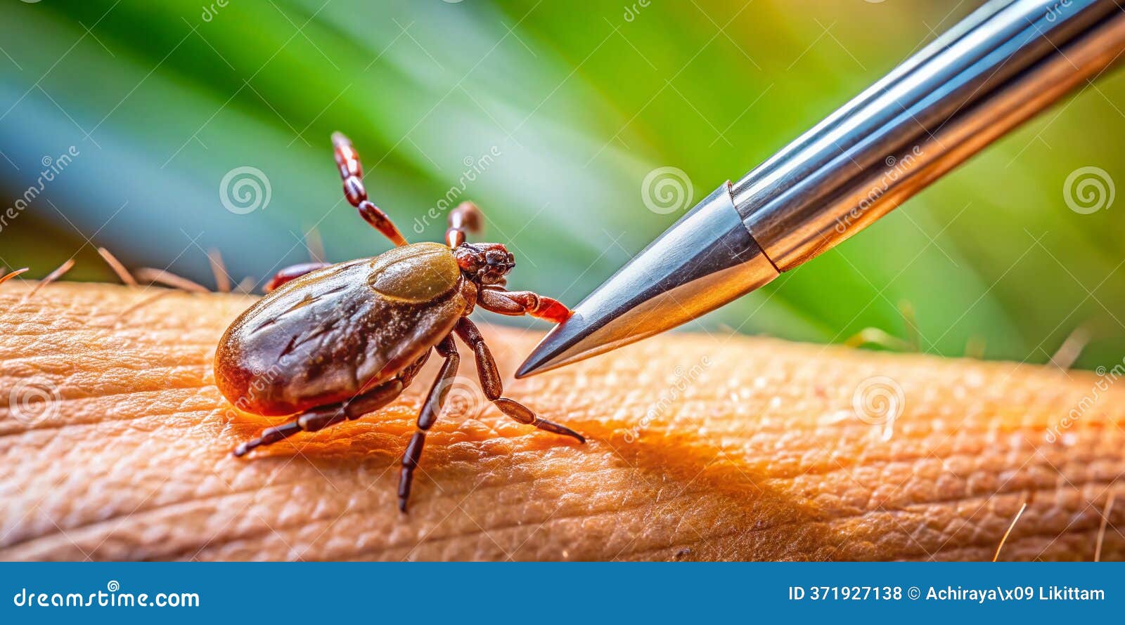 Preventing Tick Bite, Precaution Lyme Disease. Vector Illustration Of ...