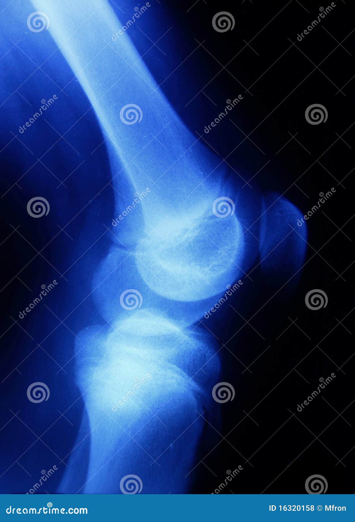 Huesos de la rodilla foto de archivo. Imagen de ciencia - 16320158