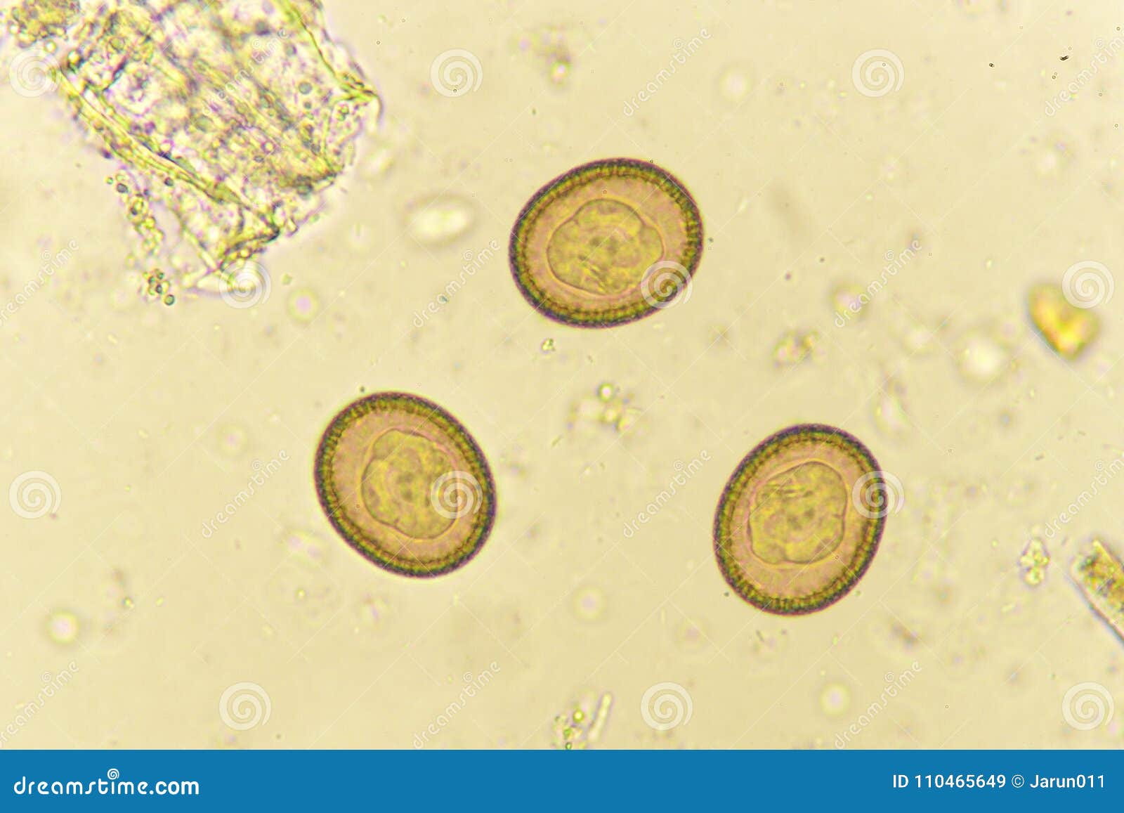 Huevo De La Tenia En Taburete Imagen de archivo - Imagen de ciencia ...