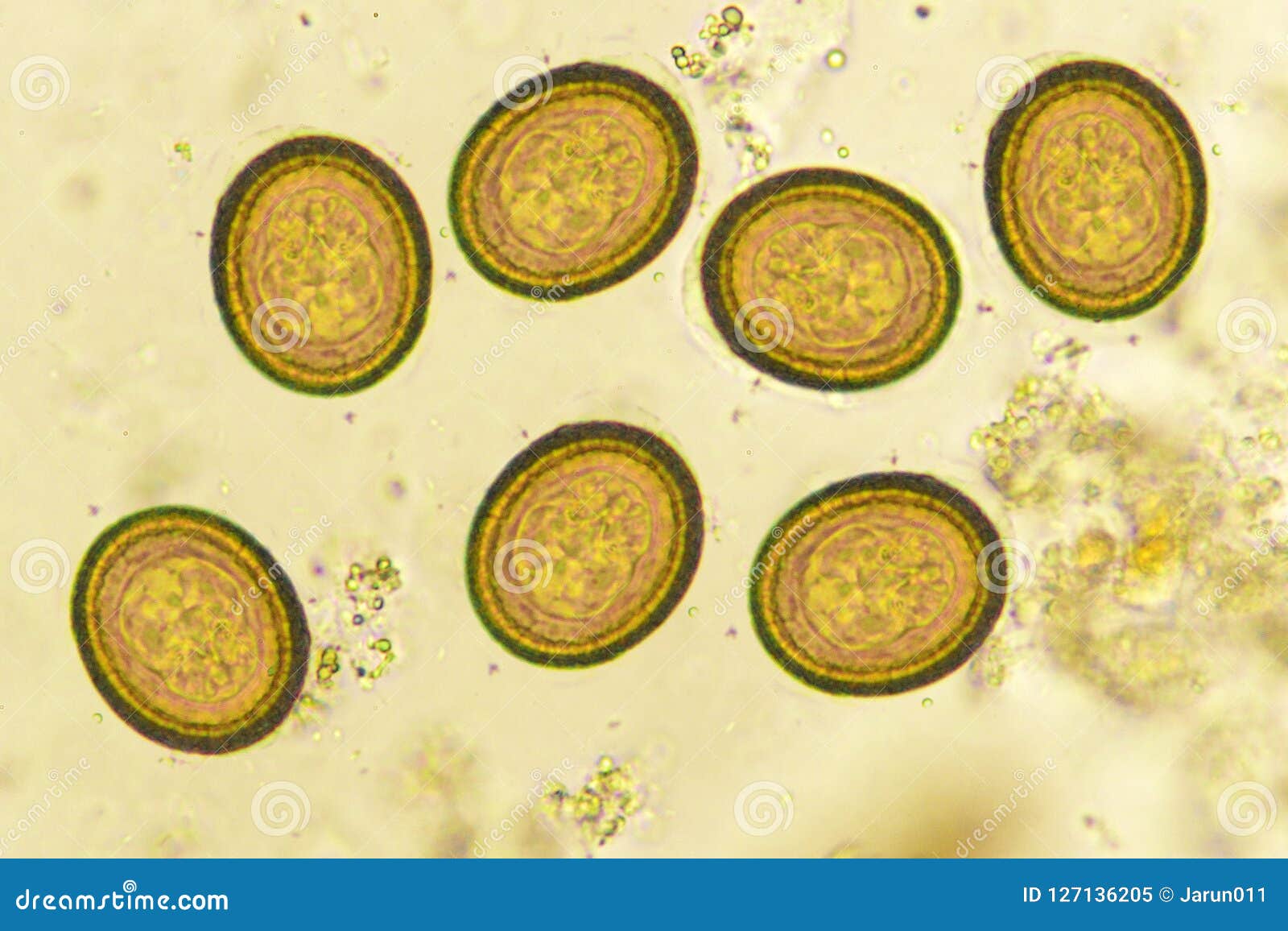 Huevos De La Tenia En Taburete Imagen de archivo - Imagen de médico ...
