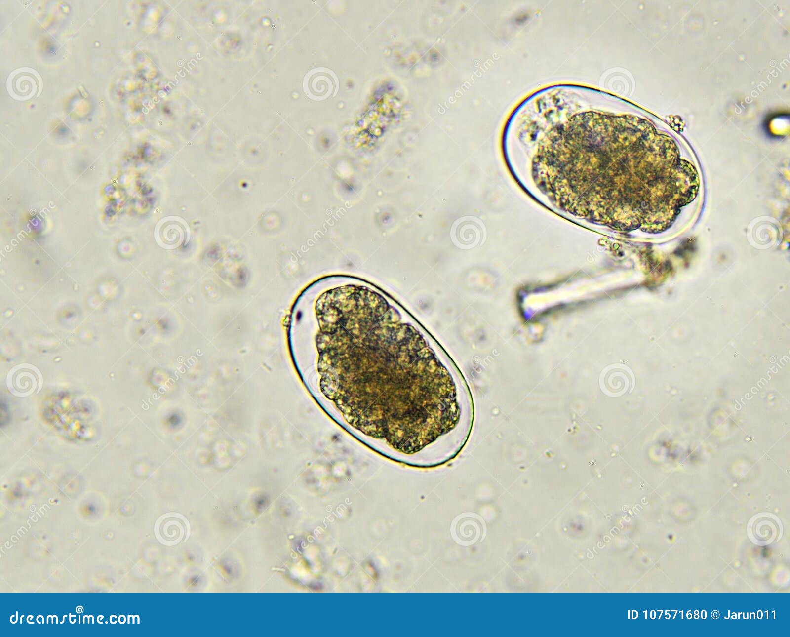 Huevos De Anquilostomas Bajo El Microscopio Macro Hookworm Huevos