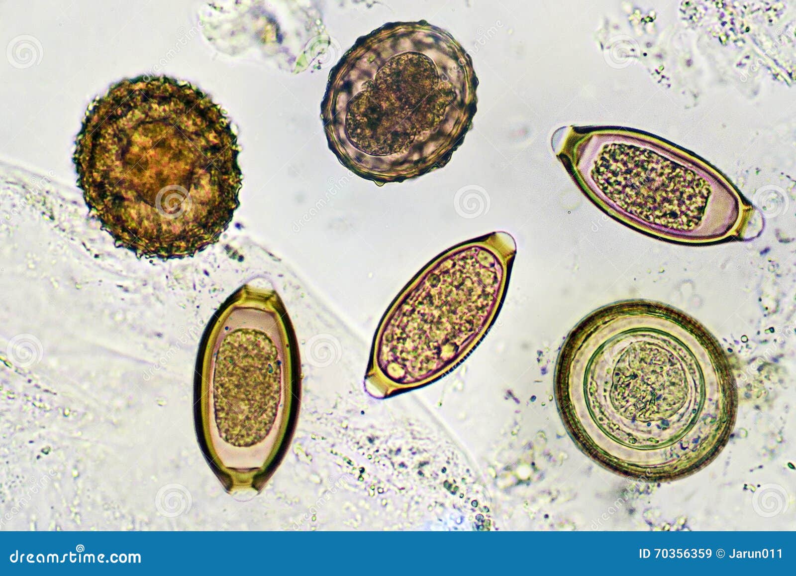 Huevos del helminto imagen de archivo. Imagen de organismo - 70356359