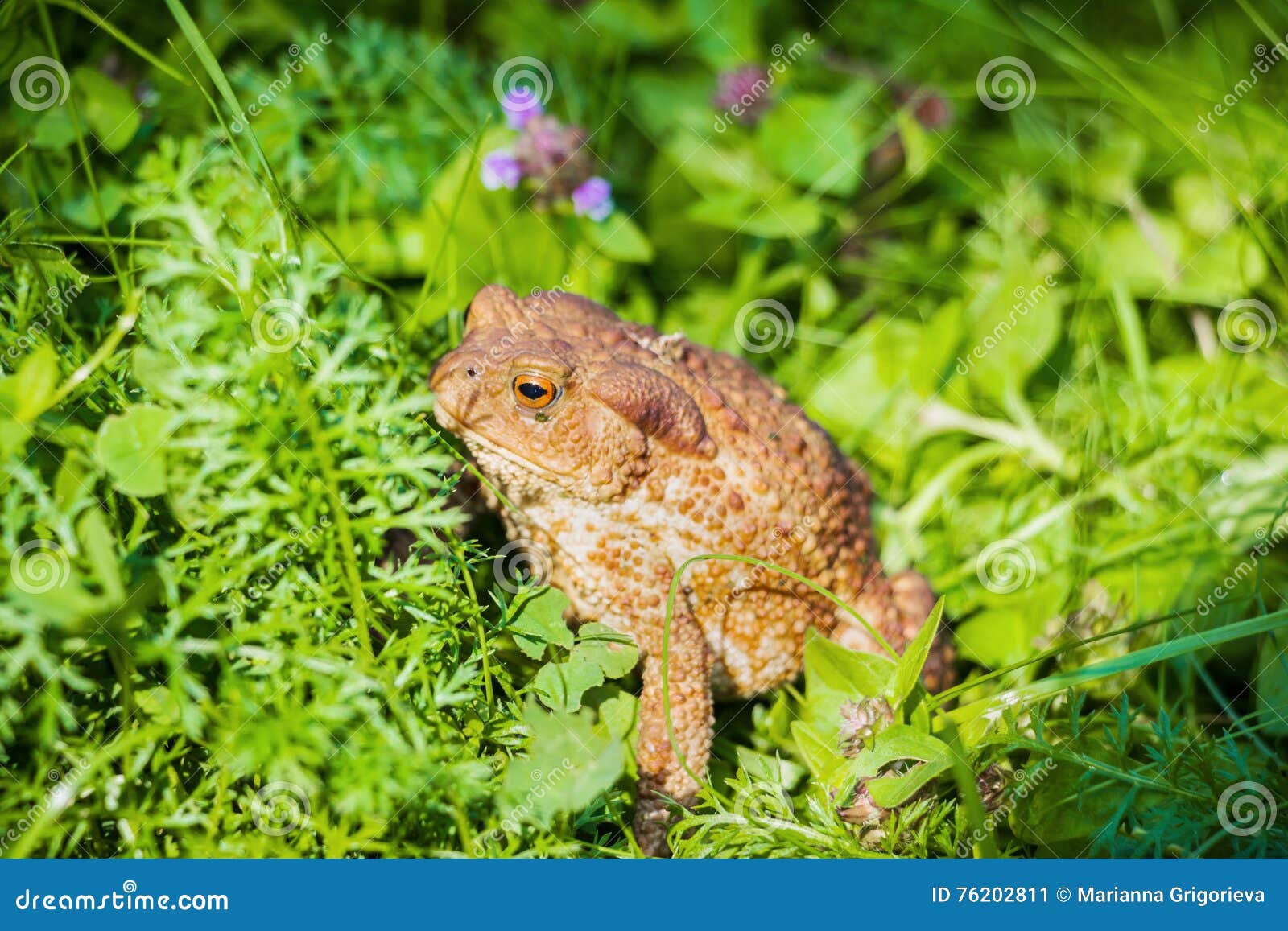Mottled Skin Heat Rash Hives Allergy Knee Close-up Blotchy Mottled Red ...