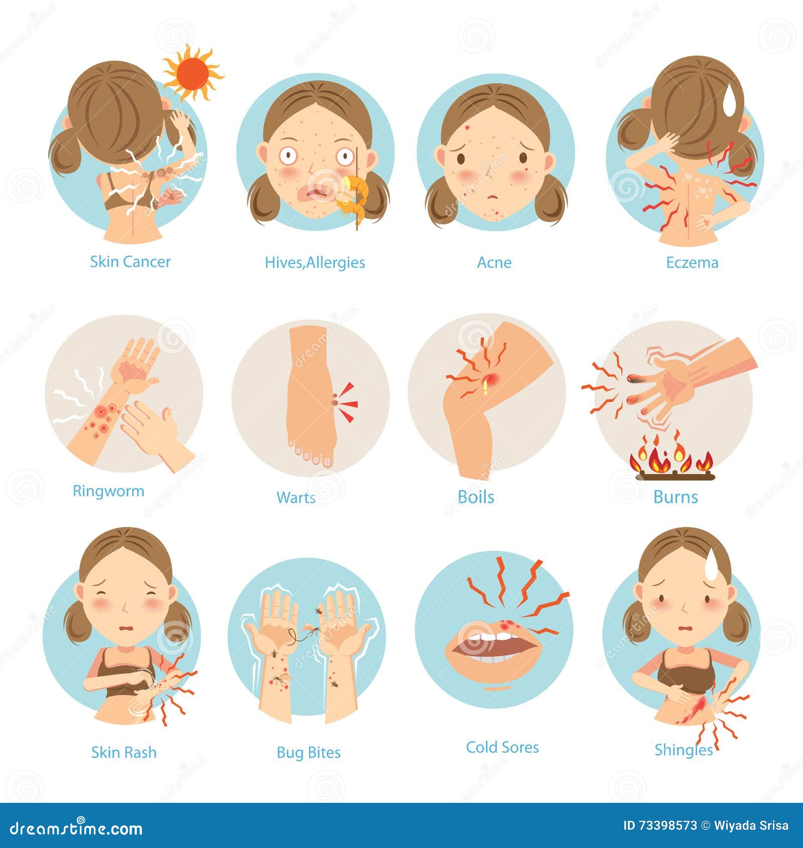 Huidproblemen vector illustratie. Illustration of kneuzing - 73398573