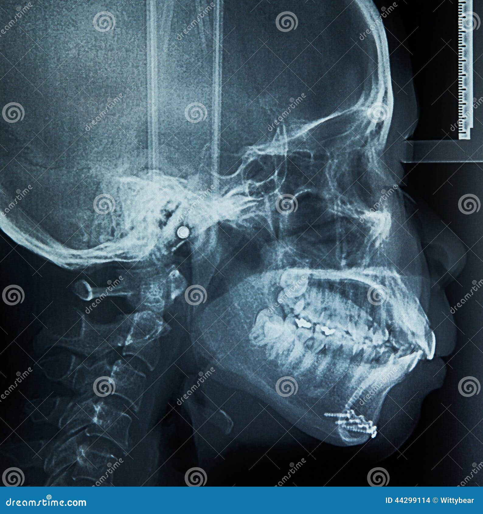 Humain De Balayage De Rayon X Photo stock - Image du humain, genou ...