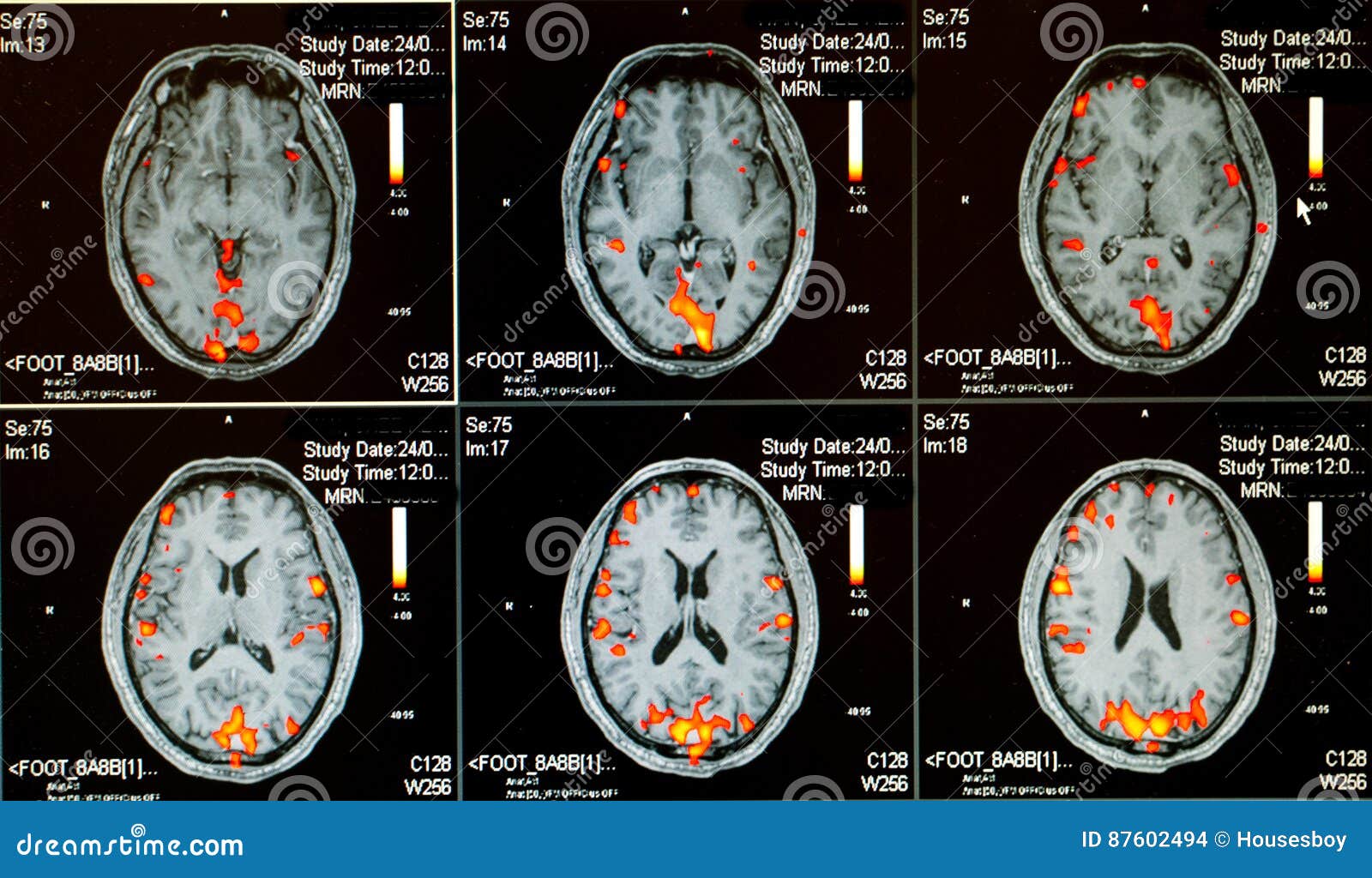Human active brain stock photo. Image of intelligence - 87602494