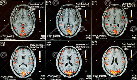 Human active brain stock photo. Image of intelligence - 87602494