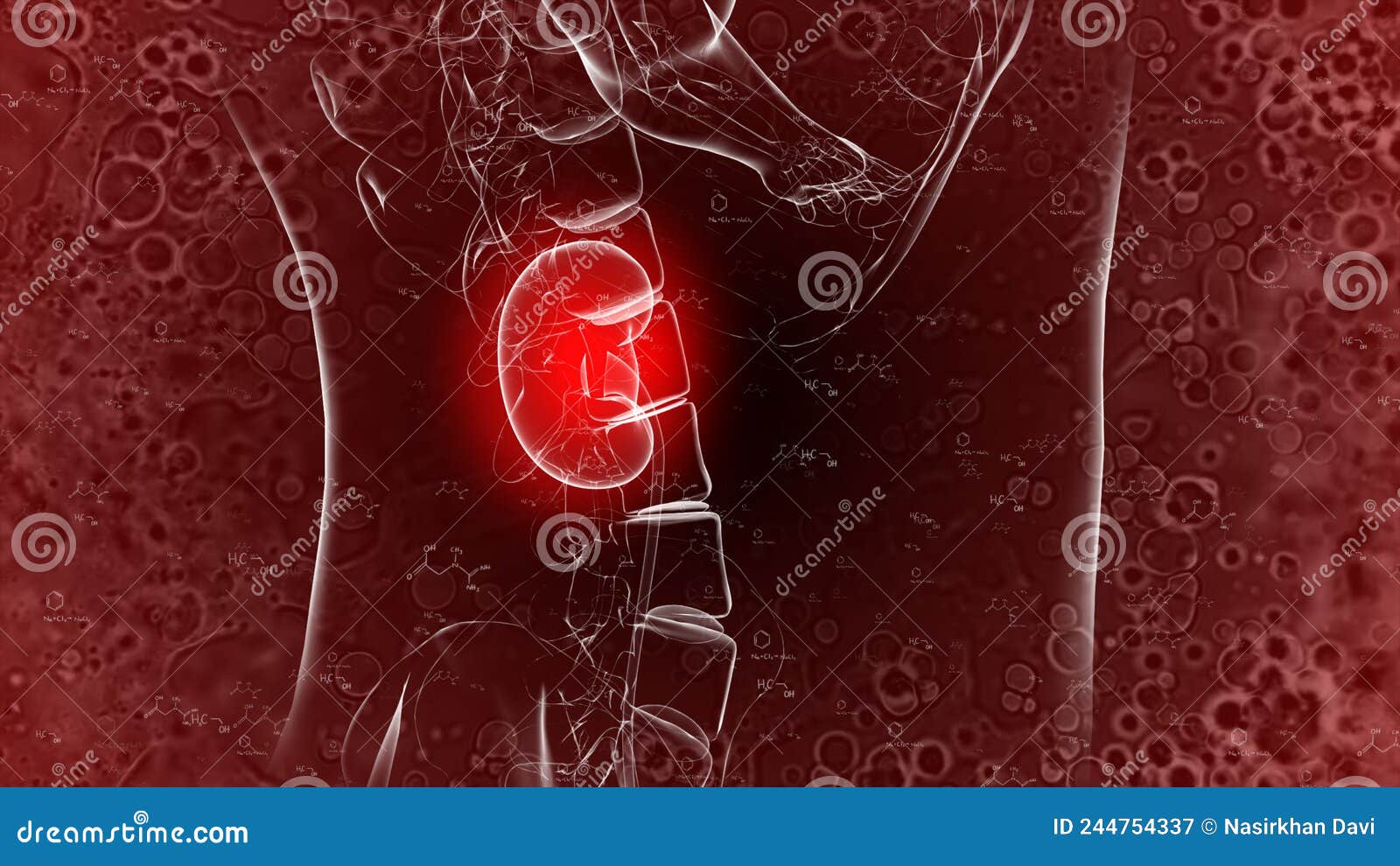 Computer Generated Human Anatomy of Kidney Pain Stock Illustration ...