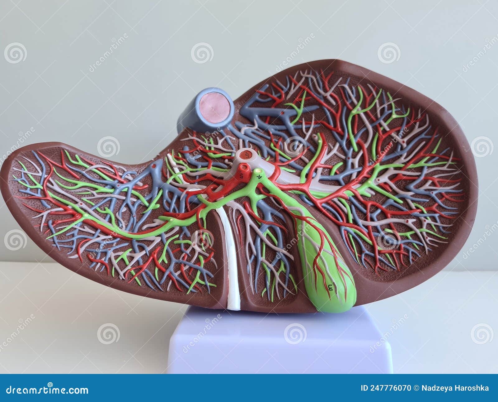 Human Anatomy Liver Model. Structure and Function of Liver and Disease ...