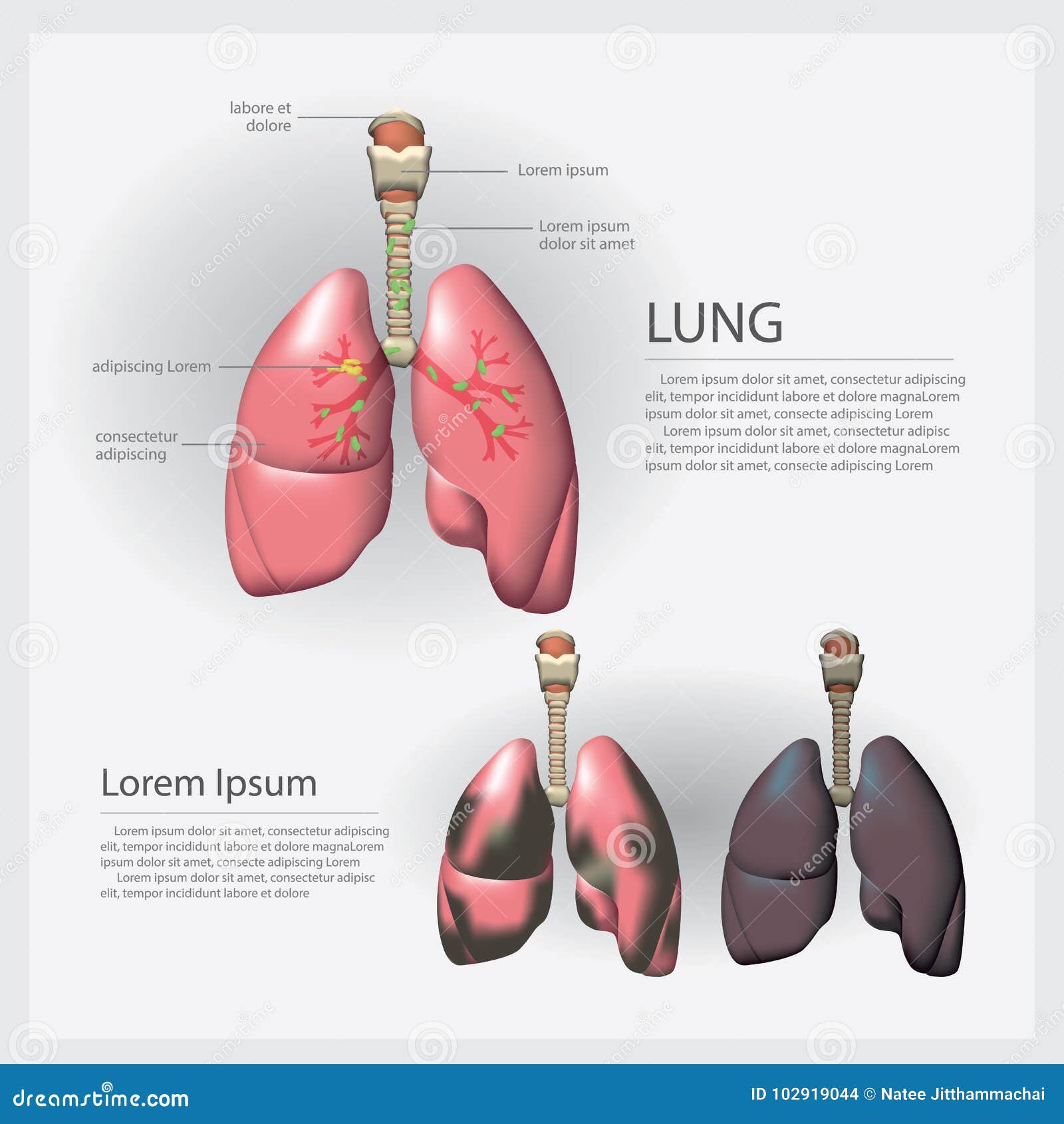 Human Anatomy Lung with Detail and Lung Cancer Stock Vector ... Human Anatomy Lung with Detail and Lung Cancer Stock Vector ...