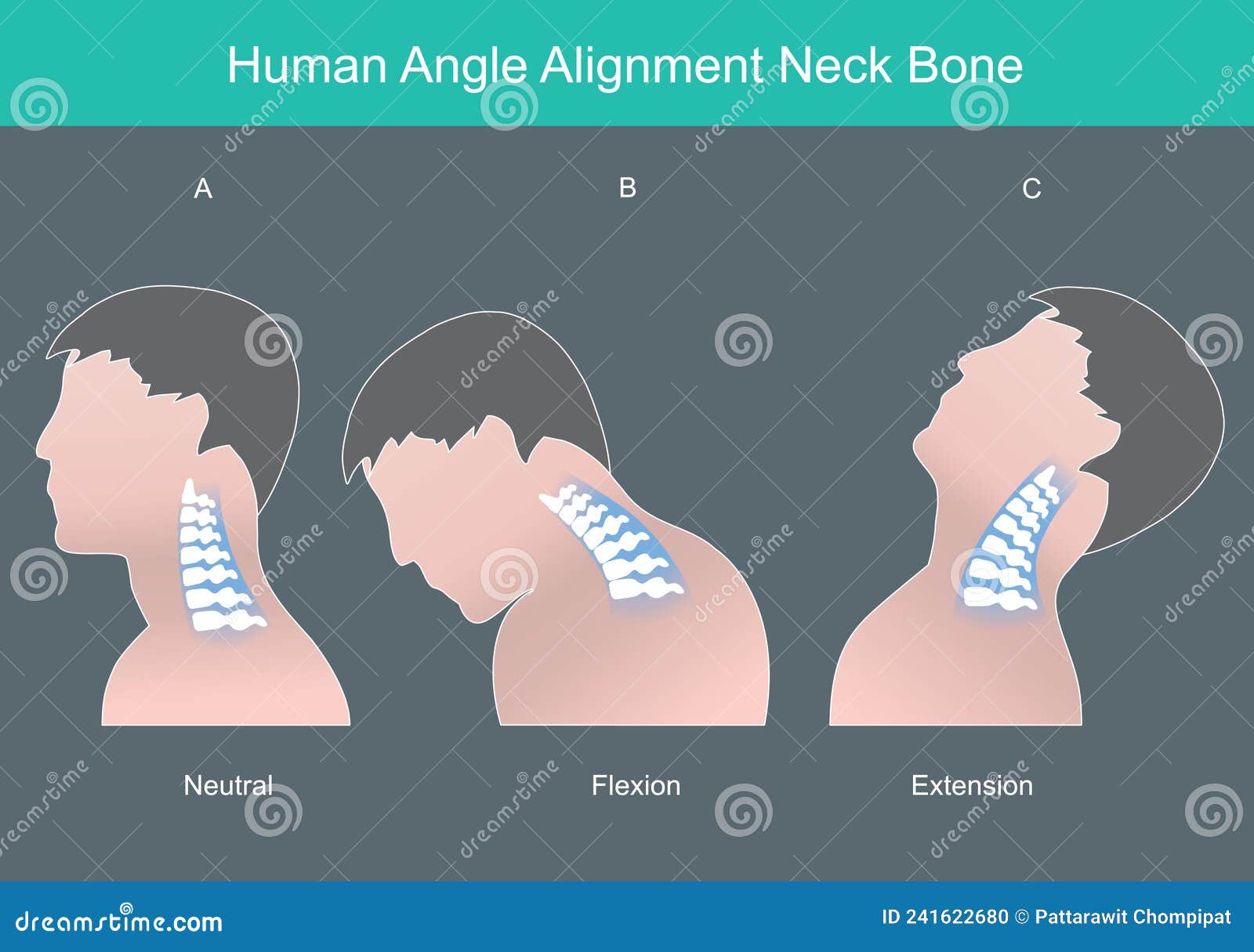 Human Angle Alignment Neck Bone. Vector Illustration | CartoonDealer ...