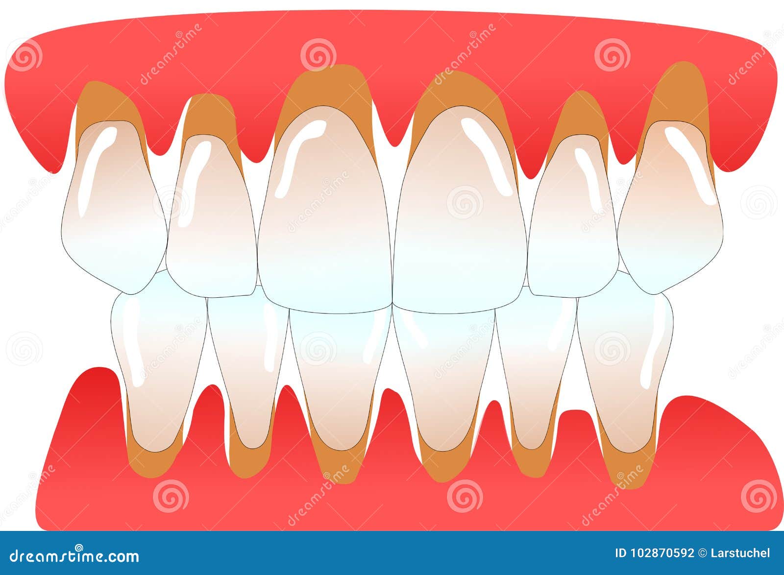 Human anterior teeth stock illustration. Illustration of dentist ...