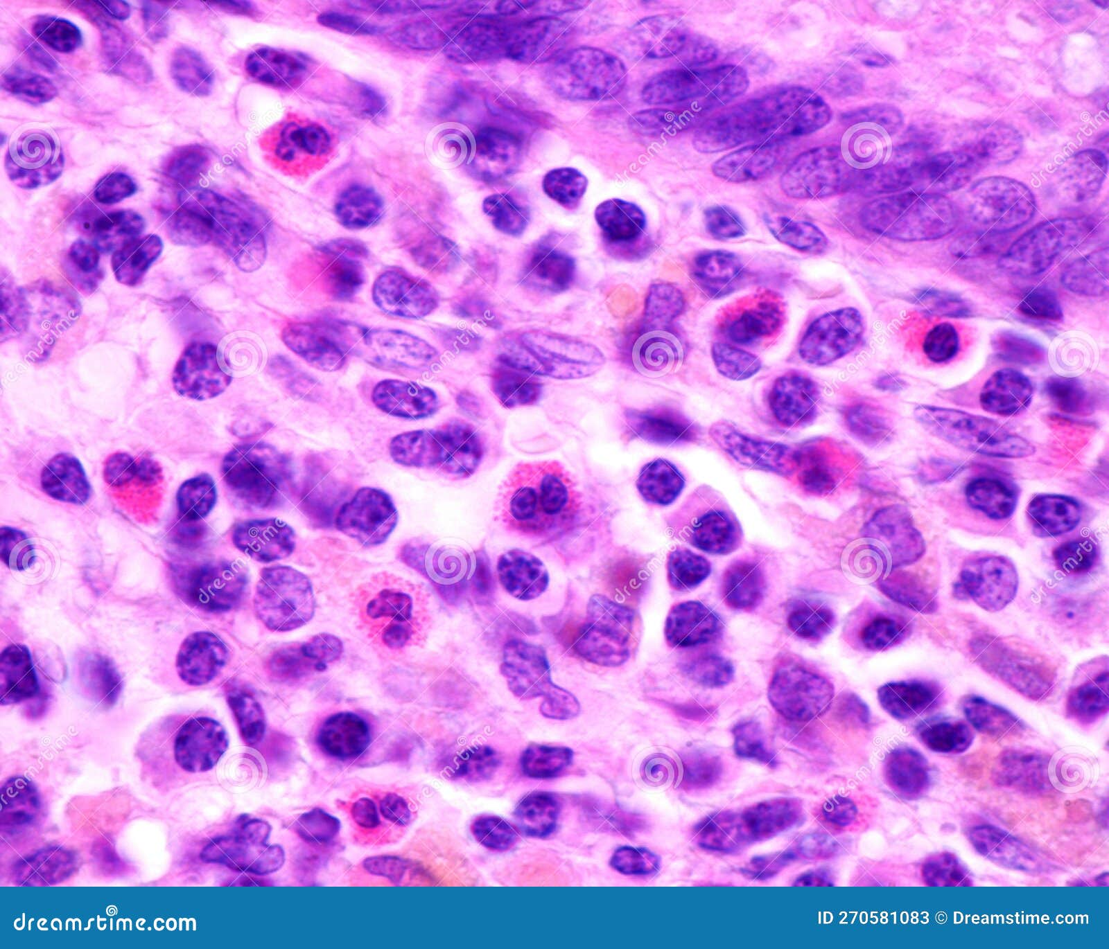 Human Appendix. Eosinophils Stock Image - Image of microscopy ...