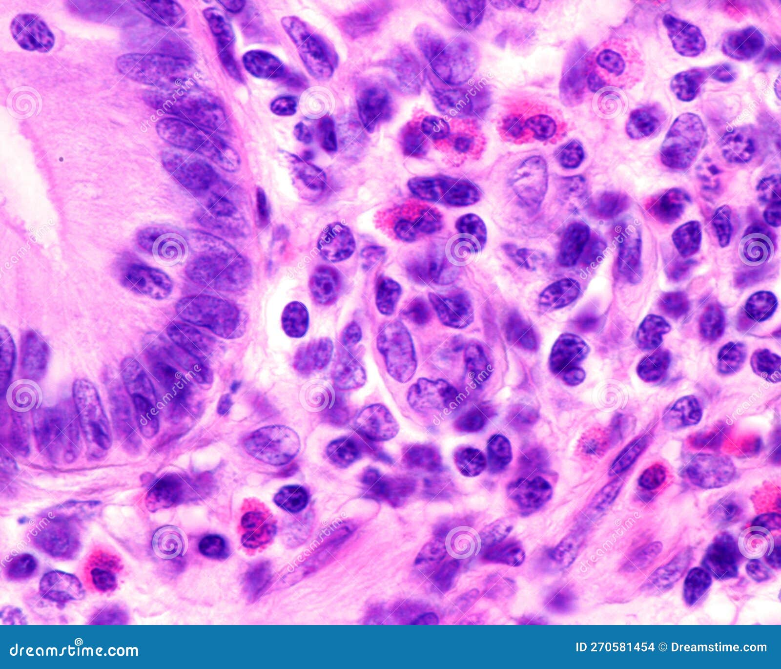 Human Appendix. Eosinophils Stock Illustration - Illustration of ...