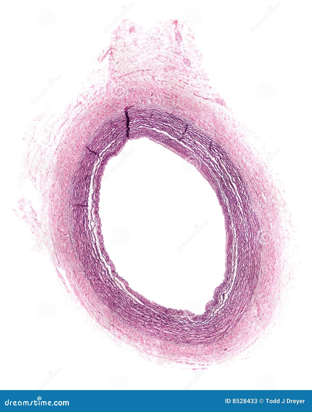 Human Artery stock image. Image of microscopic, scientific - 8528433