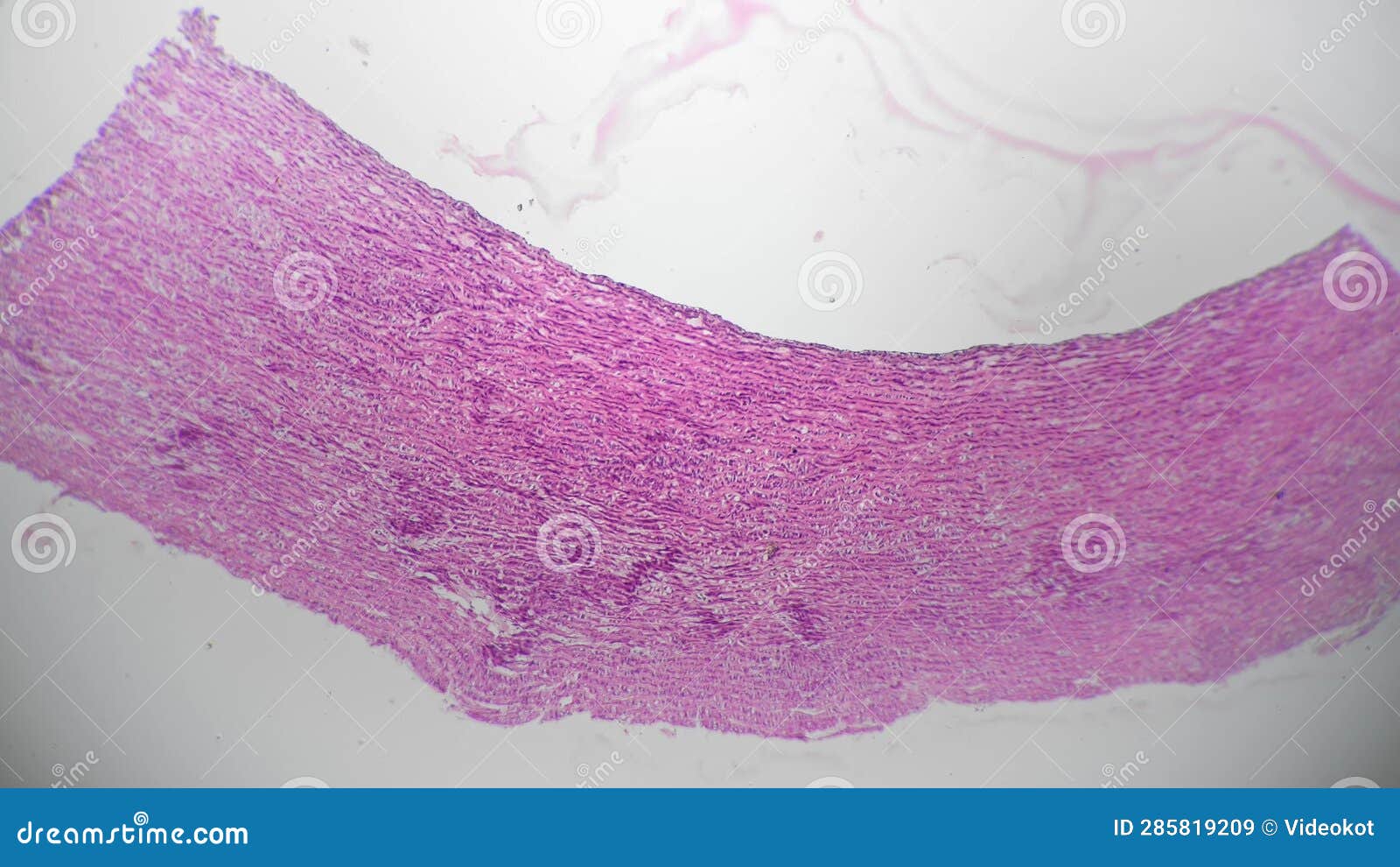 The Human Artery Section Observed Under Microscope 40x To Examine the ...