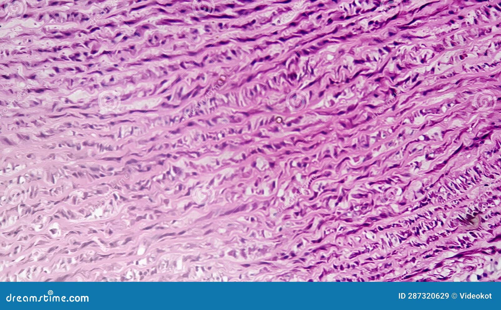 The Human Artery Section Observed Under Microscope 200x To Examine the ...
