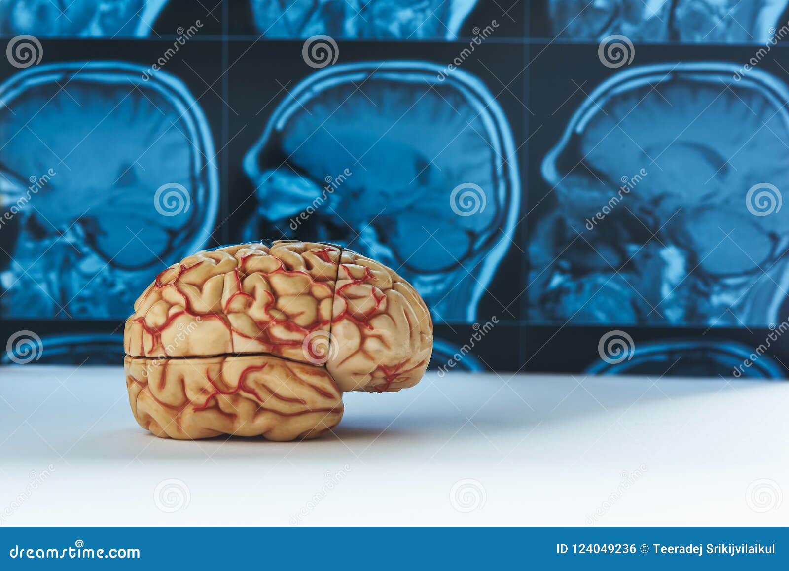 Human Brain Model and MRI Background Stock Photo - Image of ...