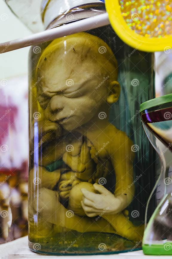 Human Baby with with Abnormal Pathological Development in Glass Jar ...