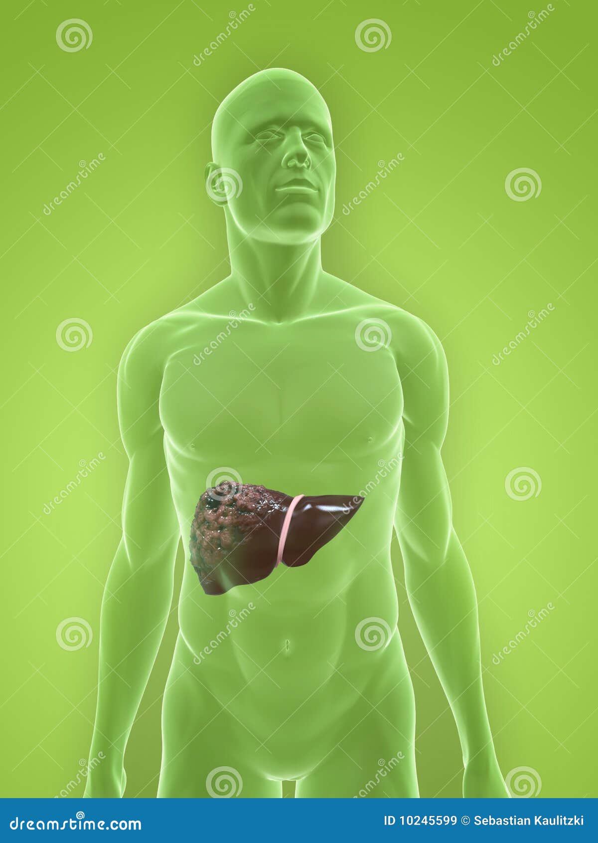 Human bad liver stock illustration. Illustration of organic - 10245599