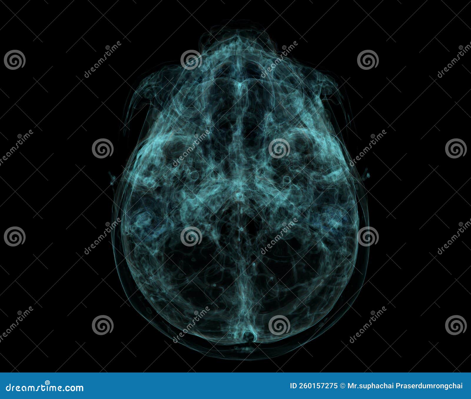 Human Skull, Brain by CT Scan. X-ray Visualization Inside of Skull. 3D ...