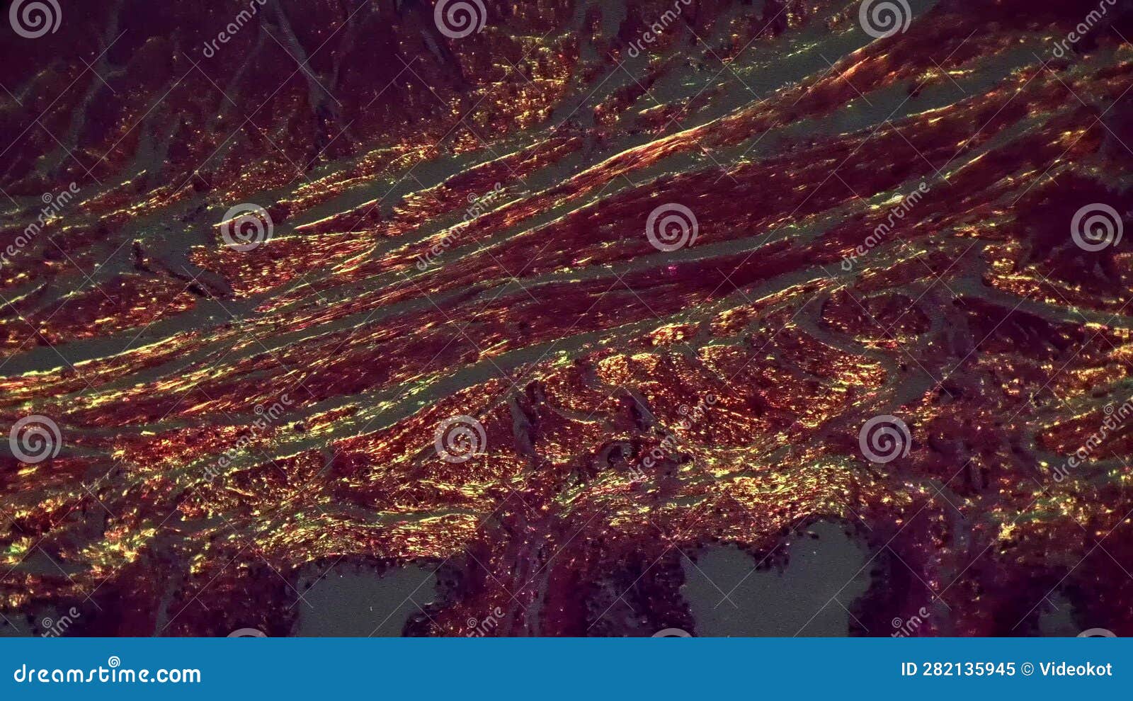 Human Bladder in Section Void Filmed Under Microscope 100x with Oblique ...