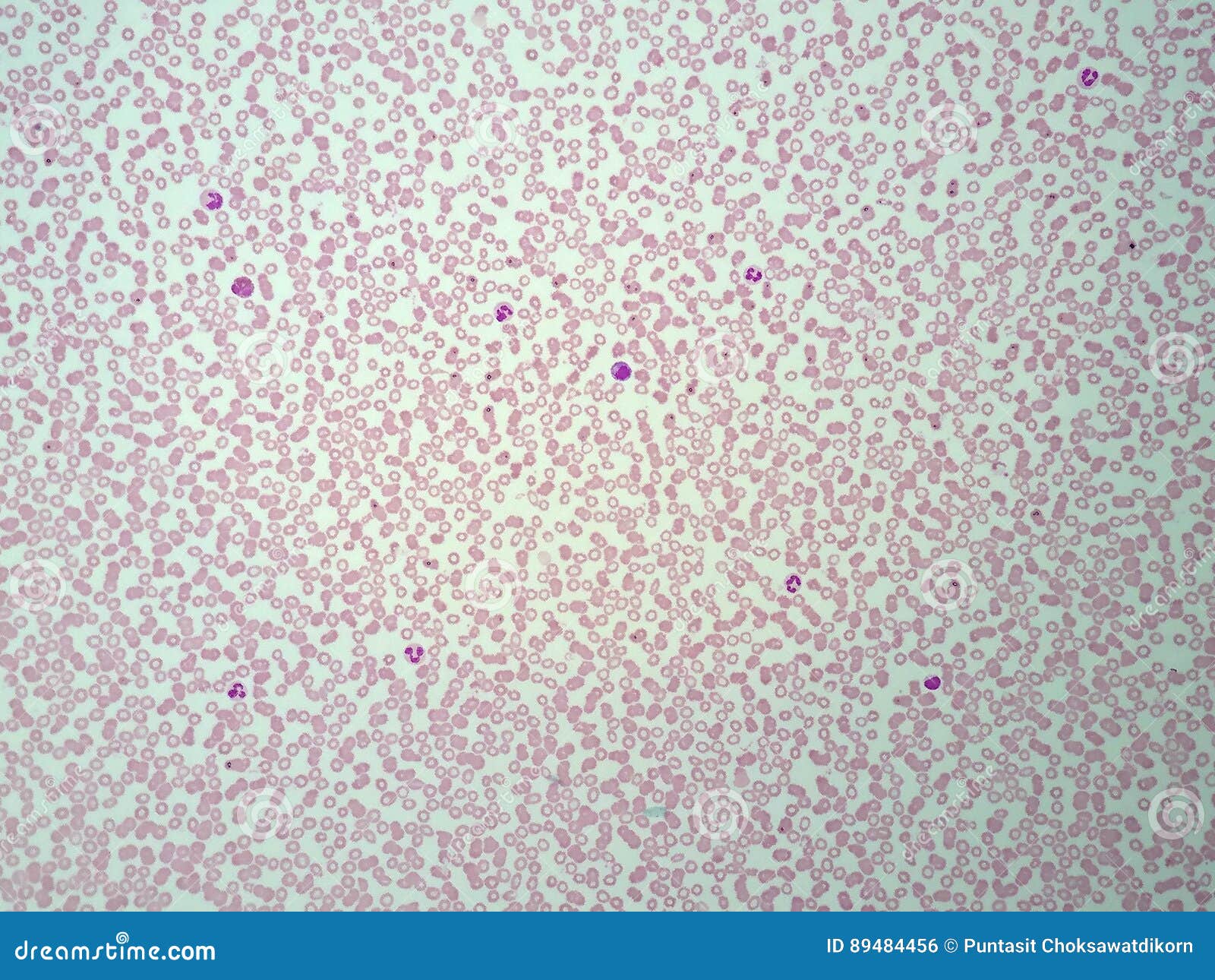 Human blood cells stock illustration. Illustration of clinic - 89484456