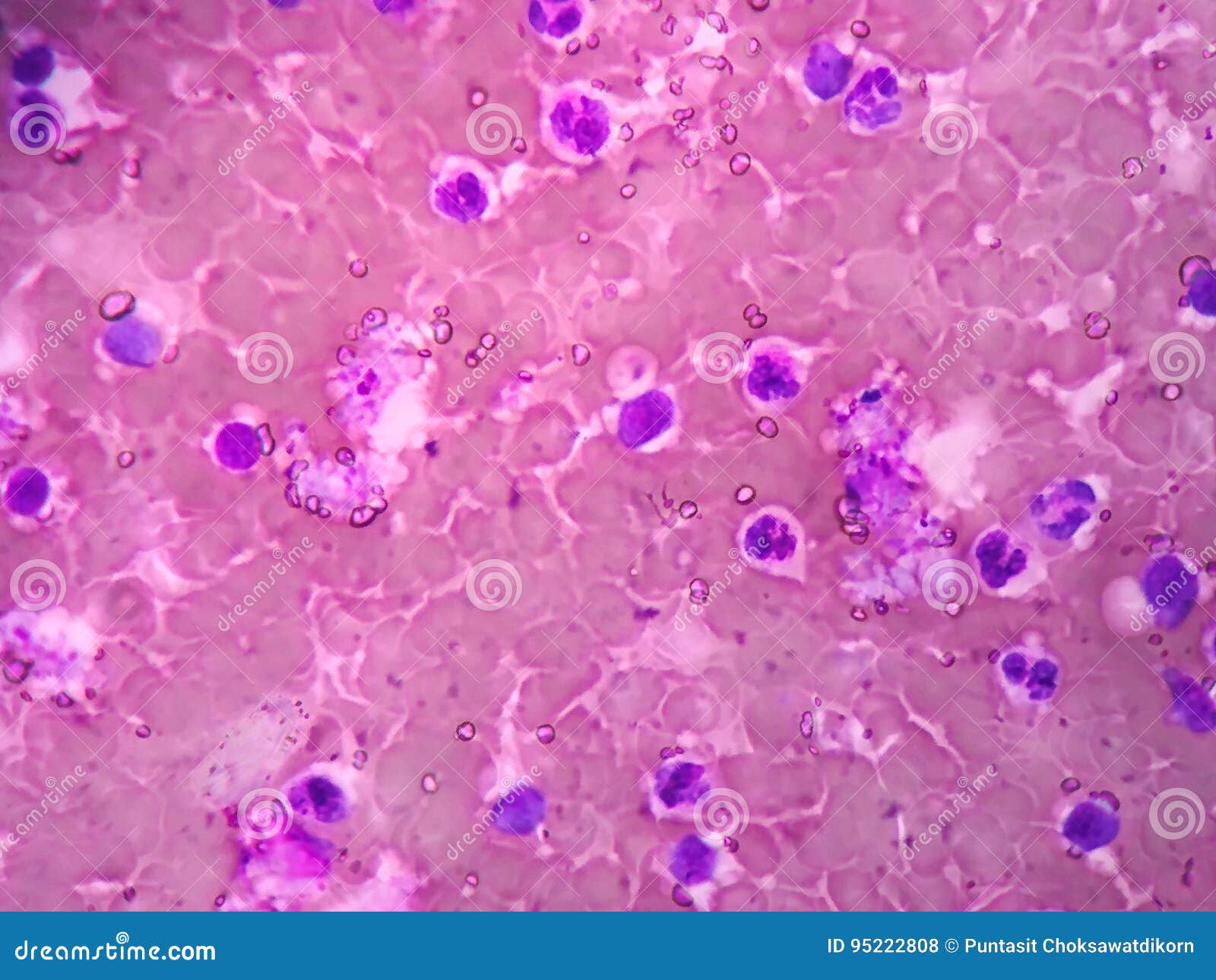 Human Blood Smear Under Microscope Royalty-Free Stock Image ...