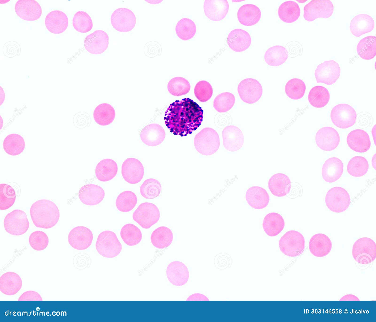 Human Blood Smear. Basophil Stock Photo - Image of basophil, leukocyte ...