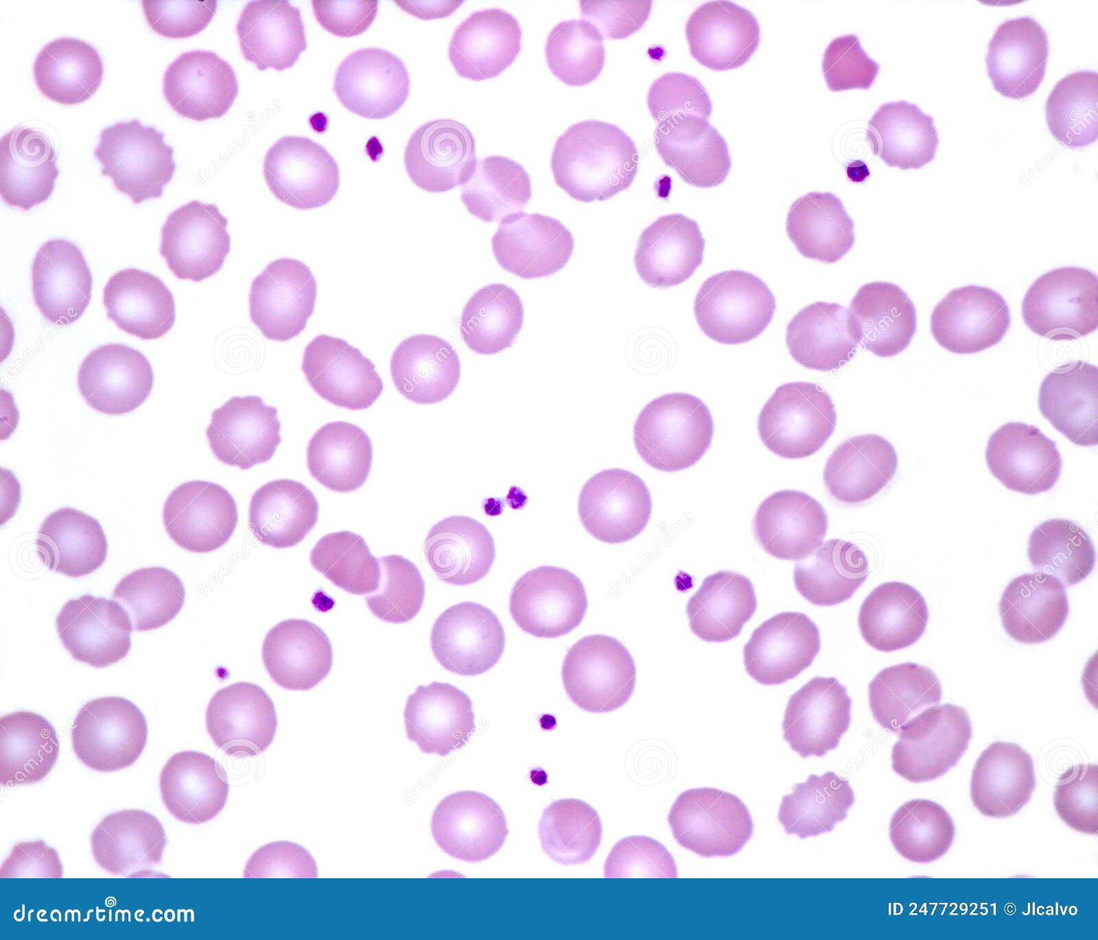 Human Blood Smear. Platelets Stock Image - Image of histology ...