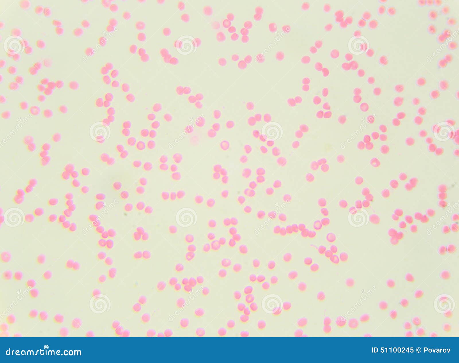 Human Blood Under the Microscope (Blood Smear Human) Stock Image ...