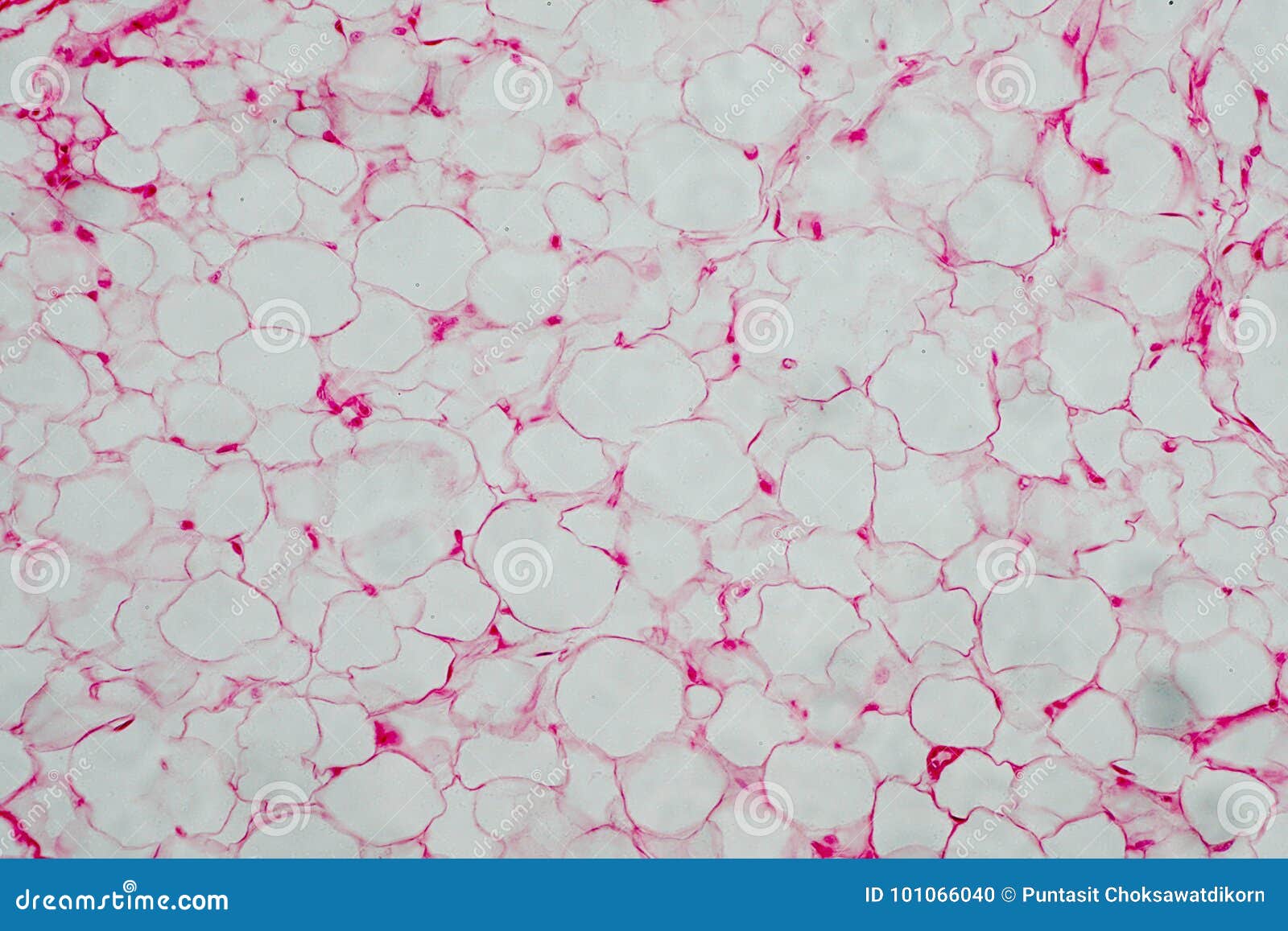 Human body fat cells stock illustration. Illustration of graphic ...