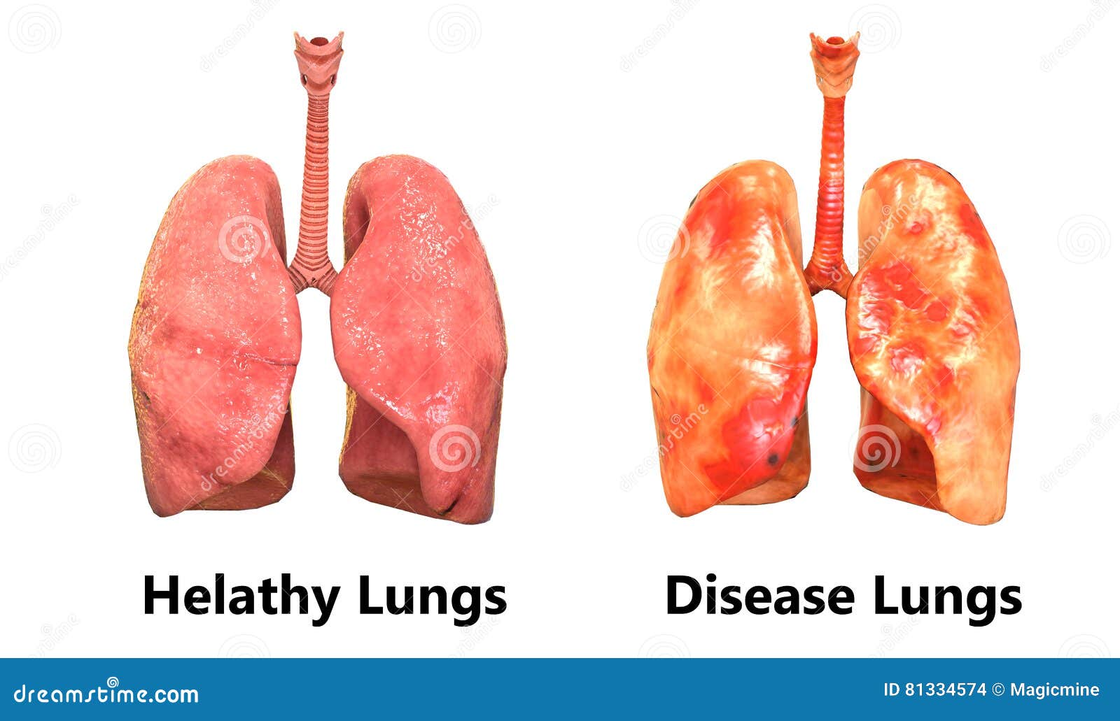 Human Body Organs Lungs Anatomy Stock Illustration - Illustration of ...