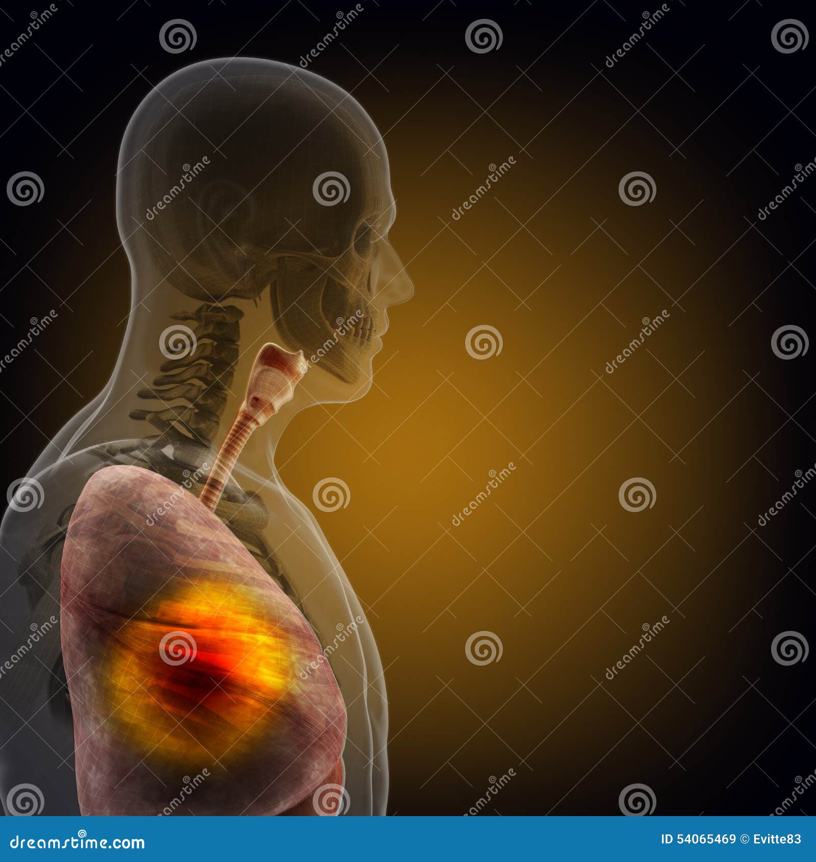 The Human Body (organs) by X-rays on Black Background Stock ...