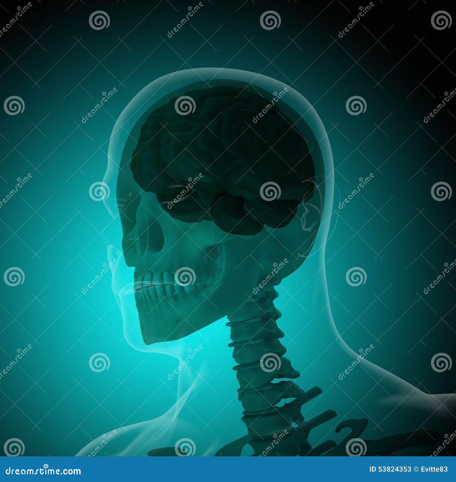 The Human Body (organs) By X-rays On Blue Background Royalty-Free Stock ...