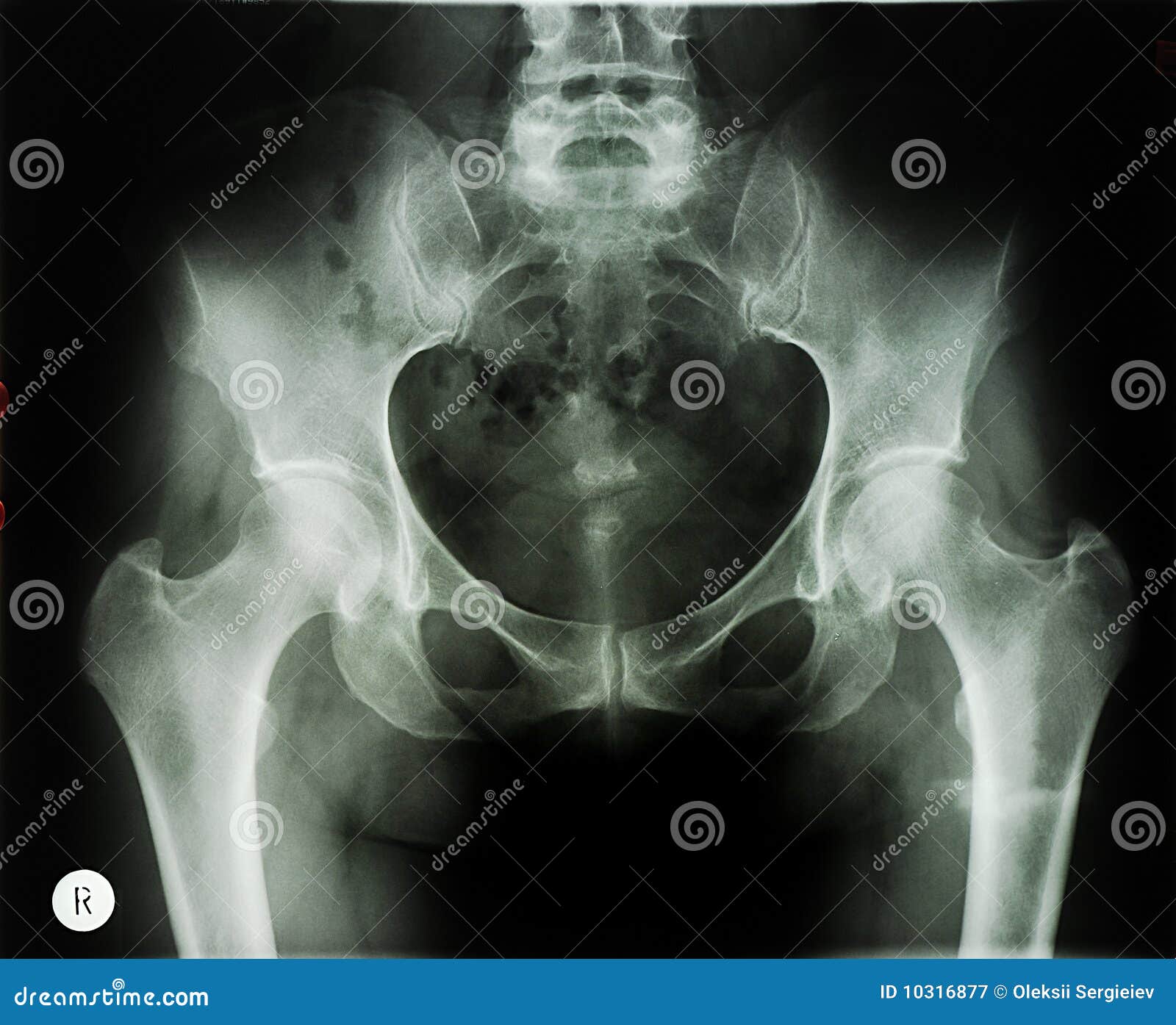 Human body s radiograph stock image. Image of film, radiation - 10316877