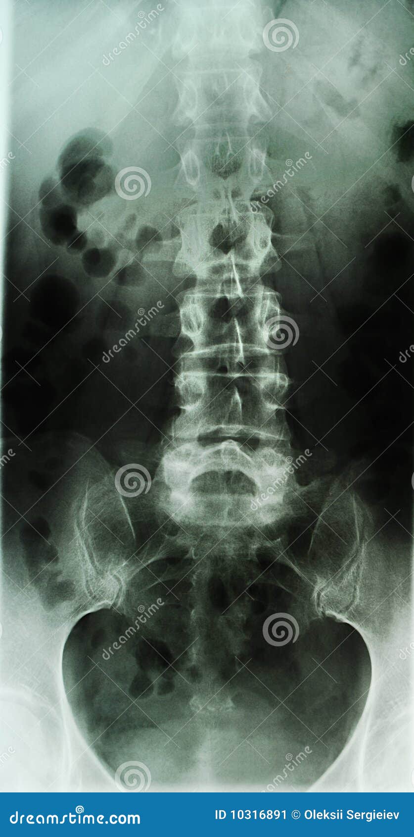 Normal Anatomy Radiology Human Body Anatomy Anatomy