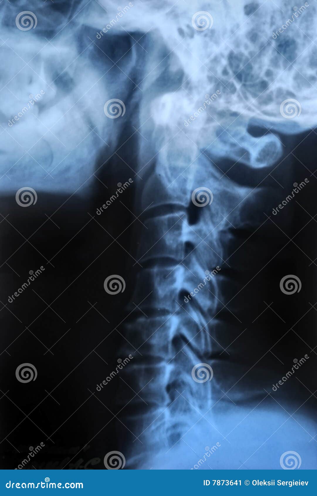 Human body s radiograph stock image. Image of lung, person - 7873641