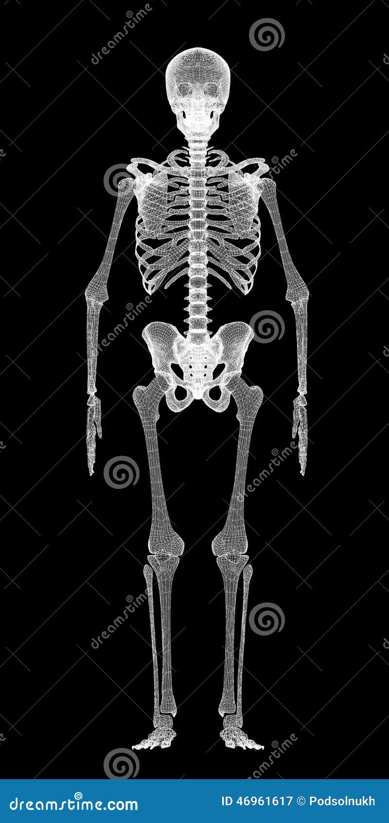 The Body And The Skeleton Of A Dead Rotten Rotten Fish. Leftovers From ...