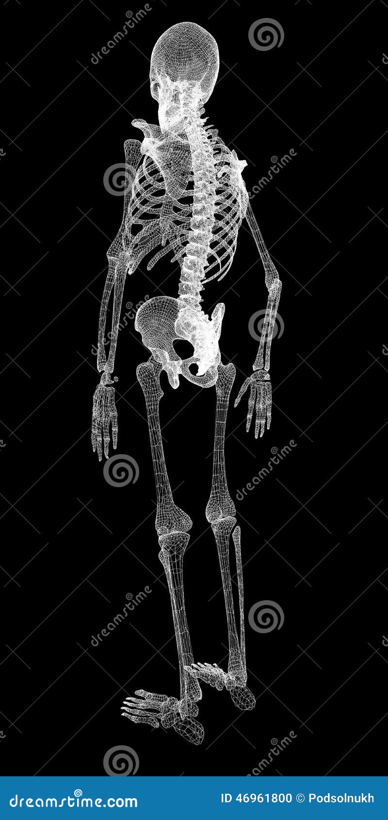 The Body And The Skeleton Of A Dead Rotten Rotten Fish. Leftovers From ...