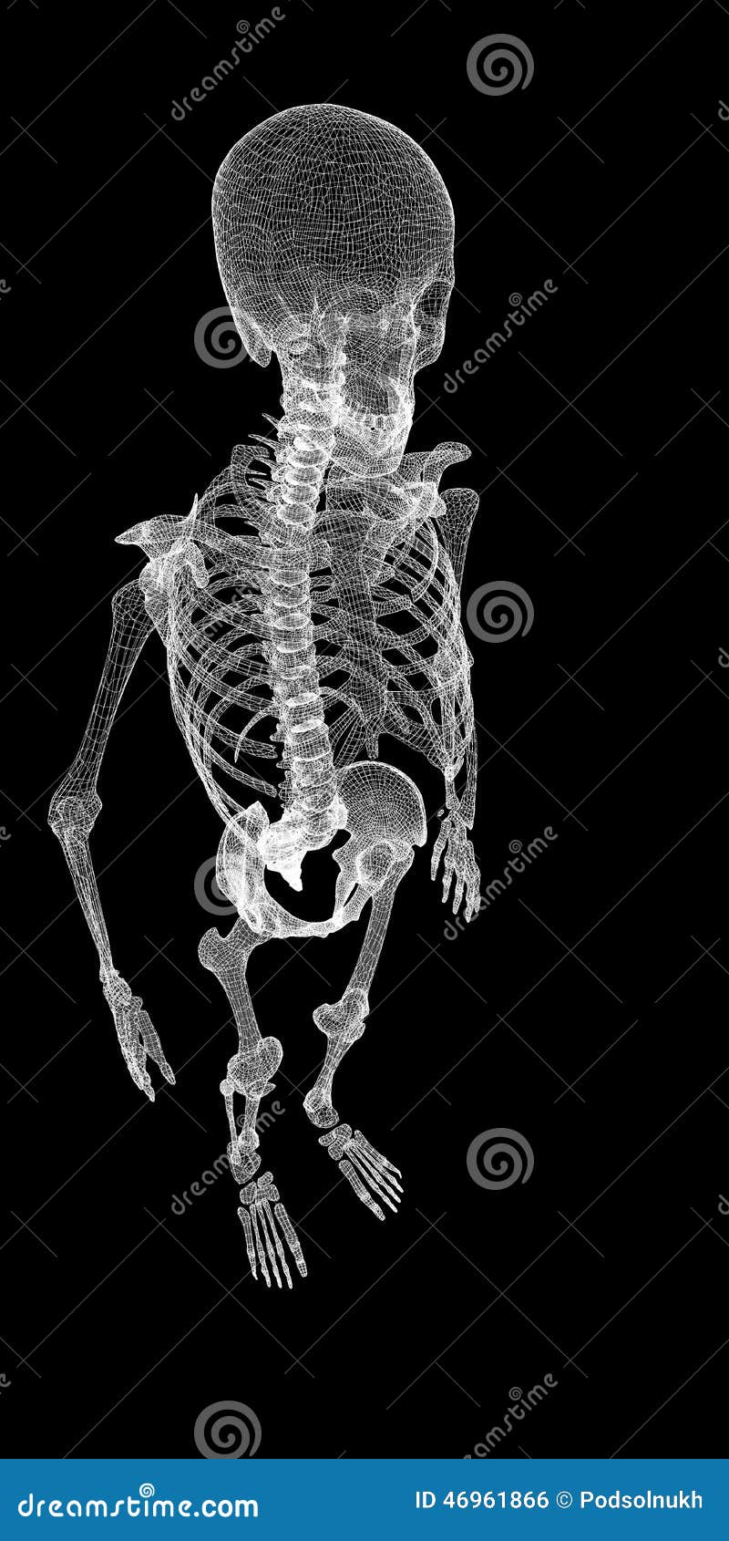 The Body And The Skeleton Of A Dead Rotten Rotten Fish. Leftovers From ...