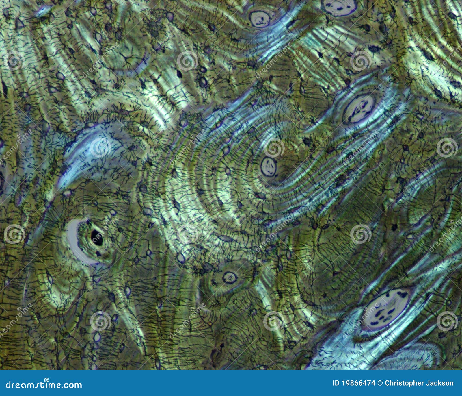 Human bone stock photo. Image of microscope, bone, cell - 19866474