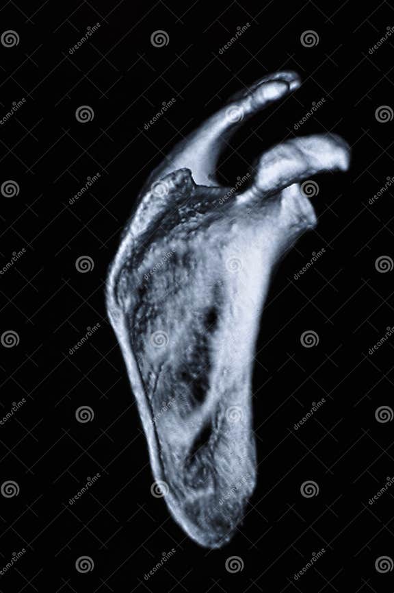 Human bone CT images stock photo. Image of human, testing - 309580046